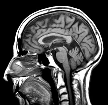 Radiology and Imaging (Diagnostic Imaging Services) – Bradford Teaching ...