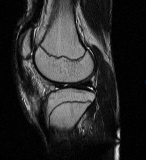 Radiology and Imaging (Diagnostic Imaging Services) – Bradford Teaching ...