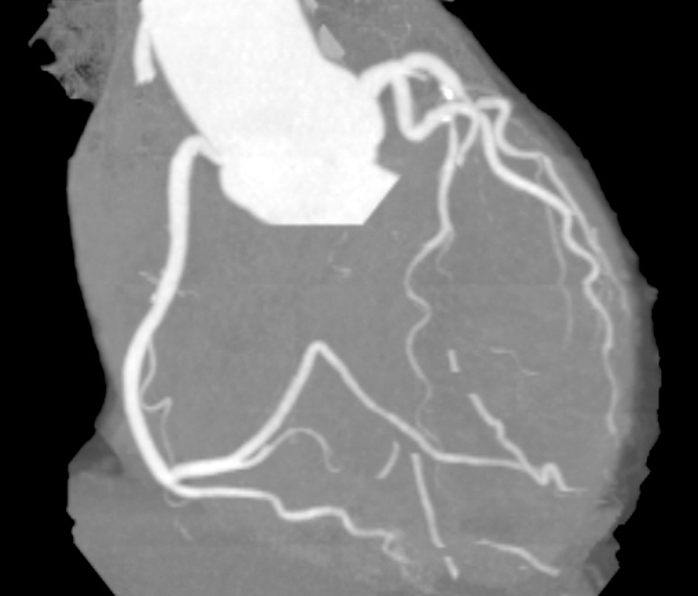 Radiology and Imaging (Diagnostic Imaging Services) – Bradford Teaching ...