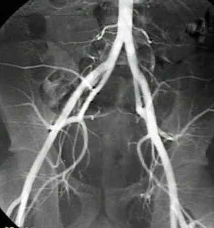 Radiology and Imaging (Diagnostic Imaging Services) – Bradford Teaching ...